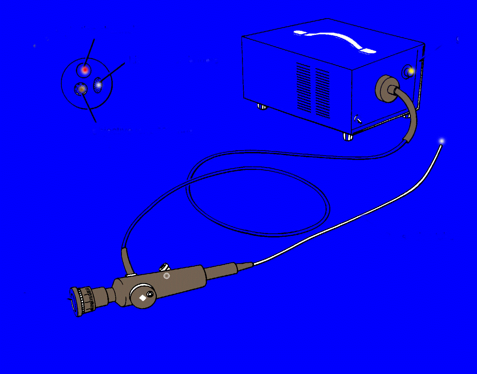 Airway Management for Maxillofacial Surgery